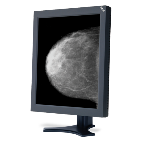 NEC MD205MG-1 20" Grayscale 5-MegaPixel Diagnostic Monitor ...
