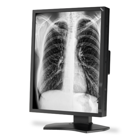 NEC MD211G3 21" Grayscale 3-Megapixel Medical Diagnostic Monitor ...