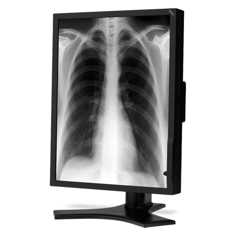 NEC MD213MG 21" Grayscale 3-Megapixel Medical Diagnostic Monitor ...
