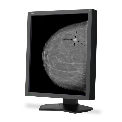 NEC MD215MG 21" 5 Mp Medical Diagnostic Display – officewonderland